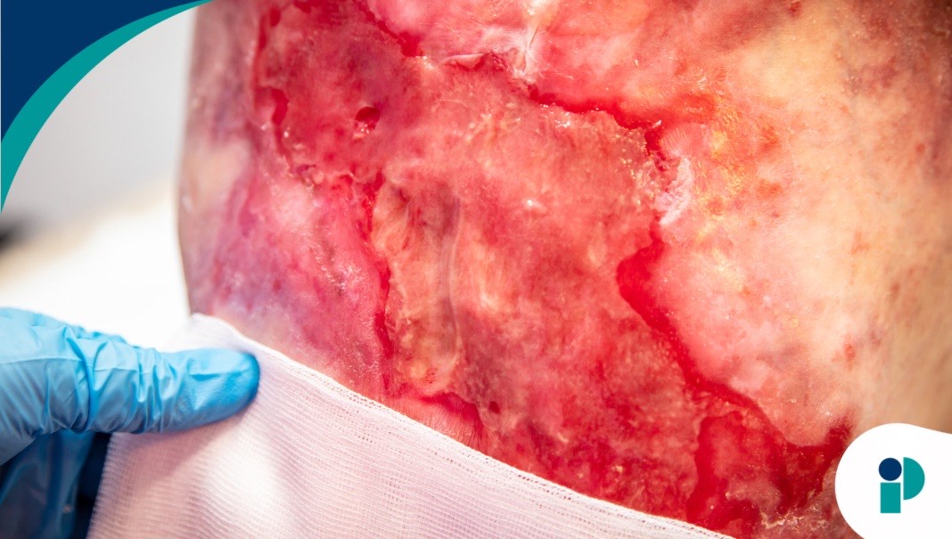 Terapia emergente con células madre: avance en el tratamiento de la ...