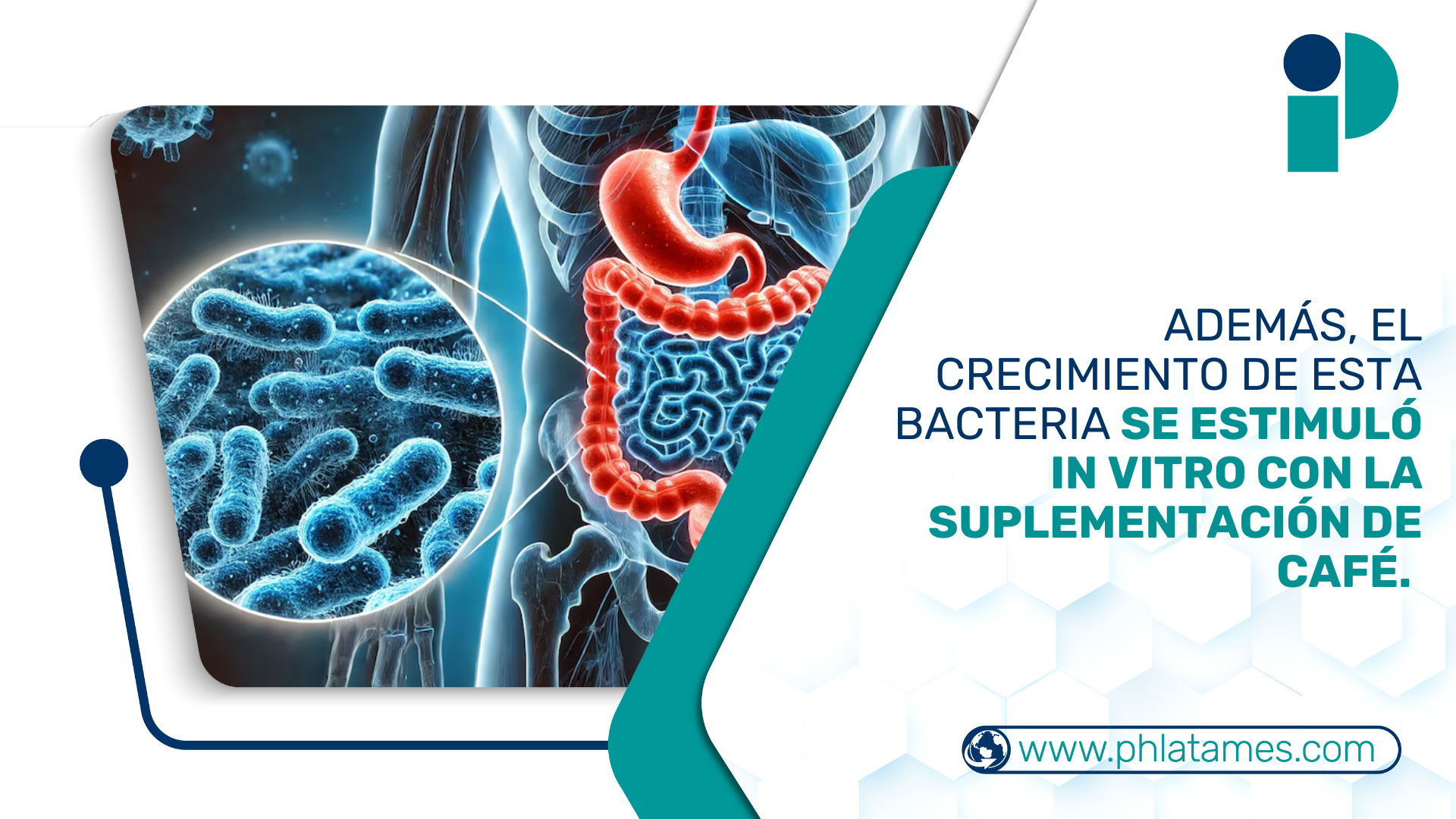 El consumo de café vinculado a una bacteria intestinal específica ...