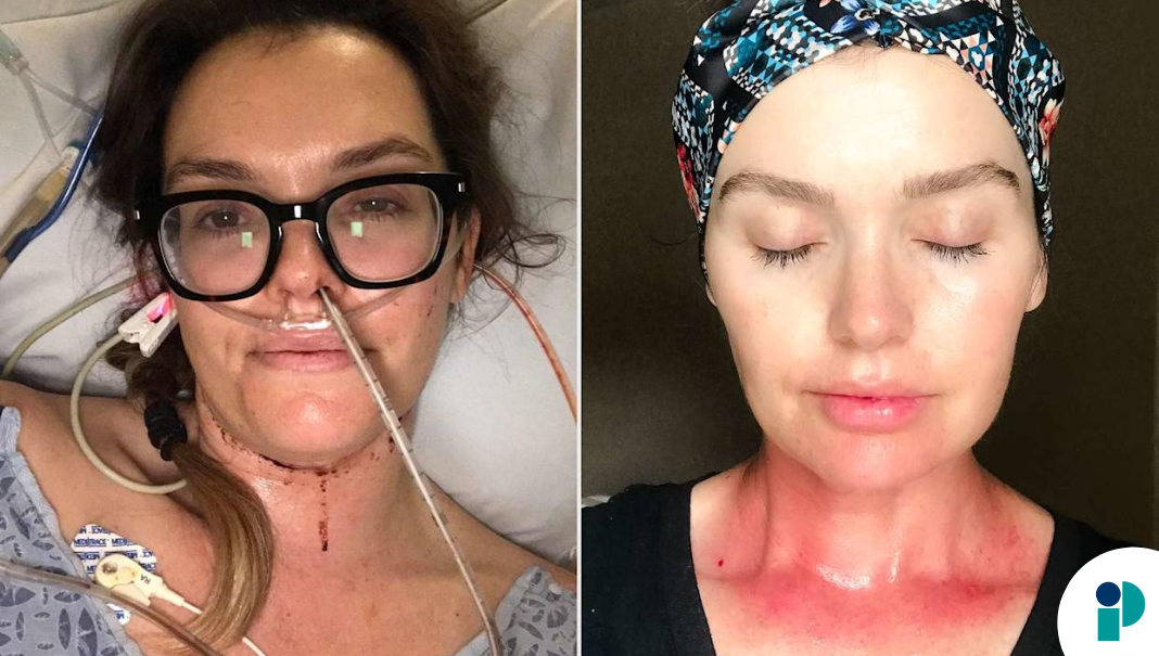 “Me dijeron que no me preocupara”: La historia de Jamie Powell y su ...